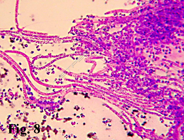 Filariosi cutanea (Dirofilaria repens) - Vetpedia l'Enciclopedia di ...