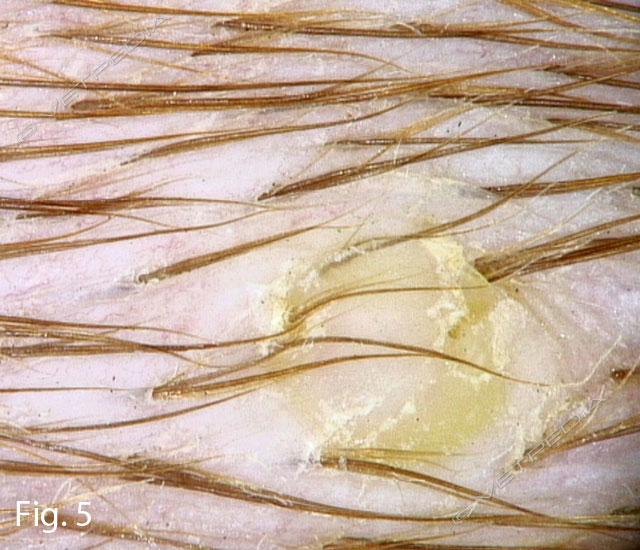 Piodermite superficiale nel cane - Vetpedia l'Enciclopedia di Medicina ...
