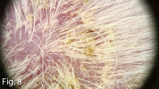 Piodermite superficiale nel cane - Vetpedia l'Enciclopedia di Medicina ...